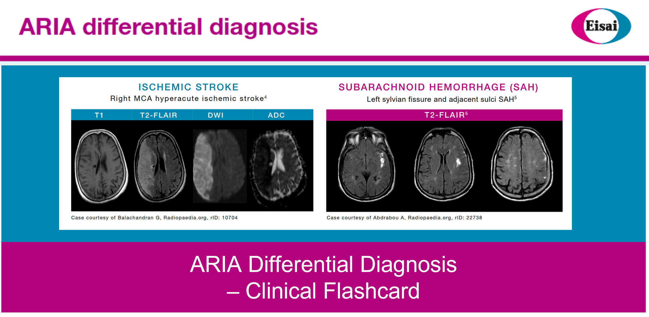 Self-Guided ARIA Educational Materials | Understanding ARIA Self-Guided ARIA Educational Materials | Understanding ARIA